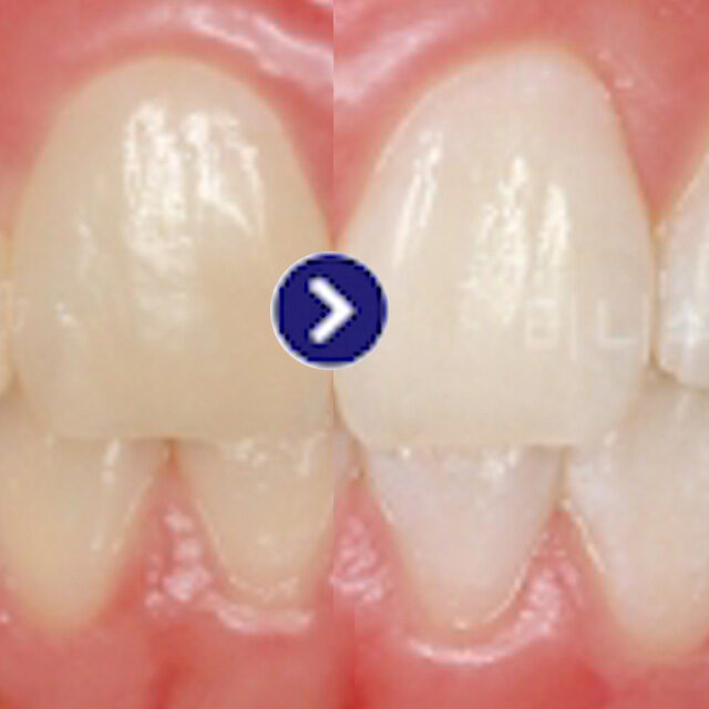 Dentist in Korea | Expats' Preferred Dentist | MINISH DENTAL