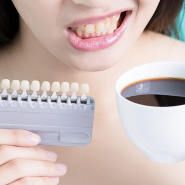 Dentist in Korea | Expats' Preferred Dentist | MINISH DENTAL