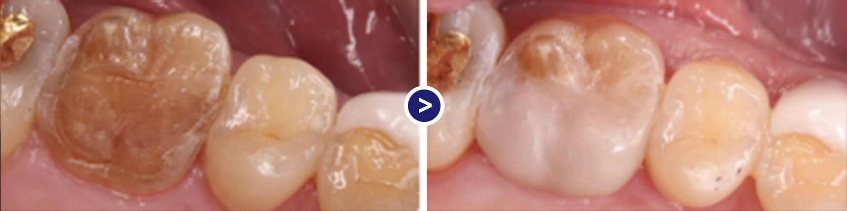 How it Works - Minish Dental Hospital